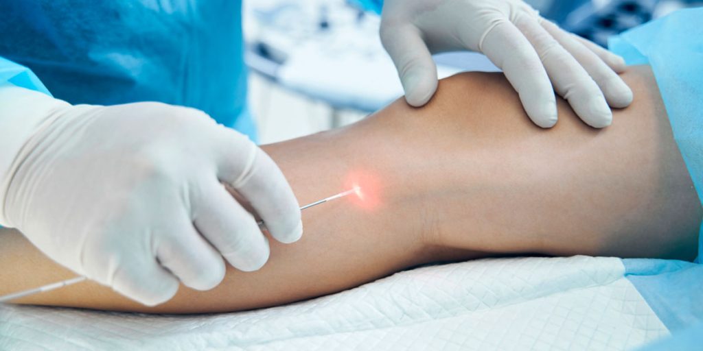 PHOMED’s Approach to High-Stability EVLA Laser Technology - PhomedLaser